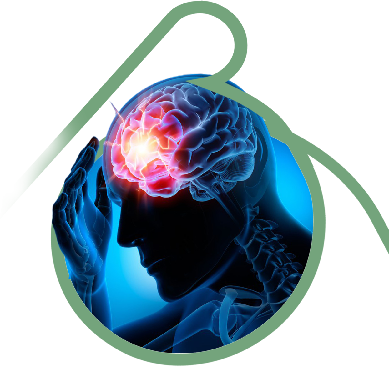 AVC – Acidente Vascular Cerebral – Bellos Laser