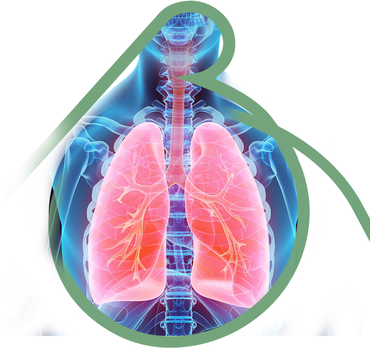 Embolia Pulmonar – Bellos Laser