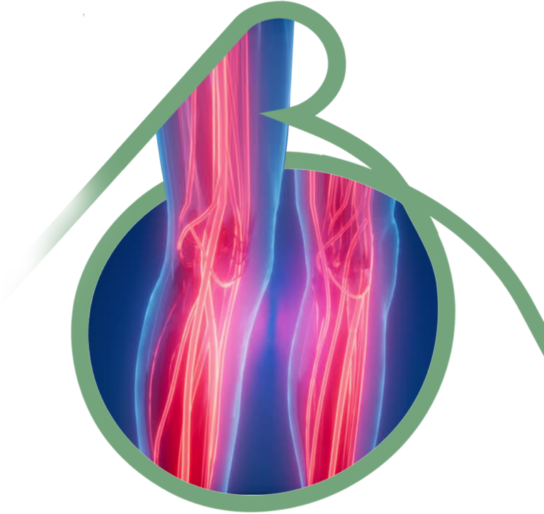 Tromboflebite – Bellos Laser