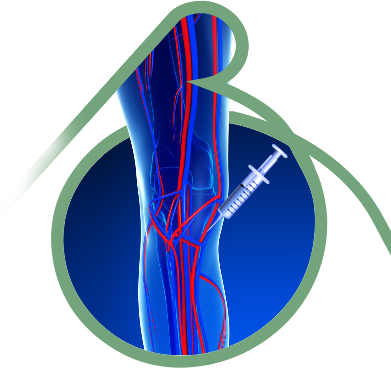 Úlcera Varicosa com Espuma Densa – Bellos Laser