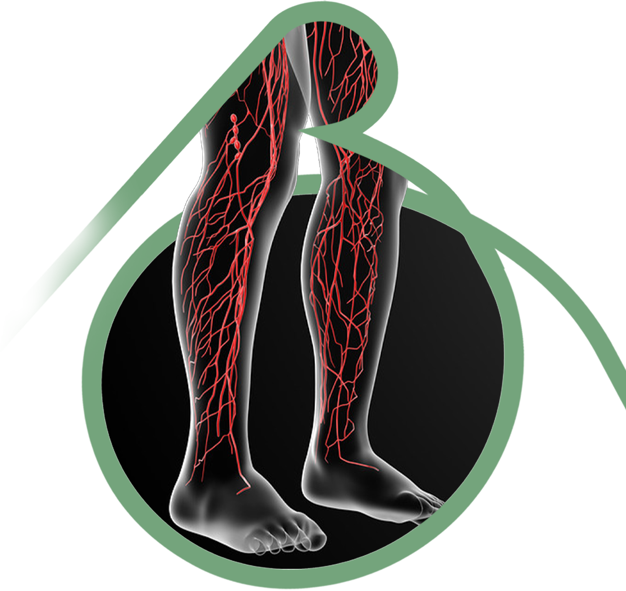 Varizes – Bellos Laser